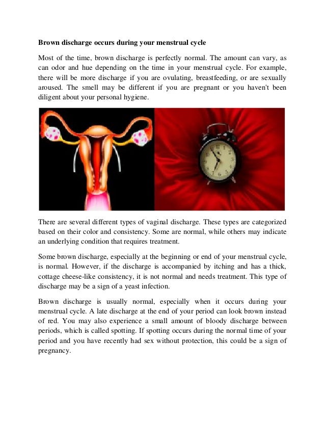 Brown Discharge Occurs During your Menstrual Cycle brown-discharge-occurs-during-your-menstrual-cycle