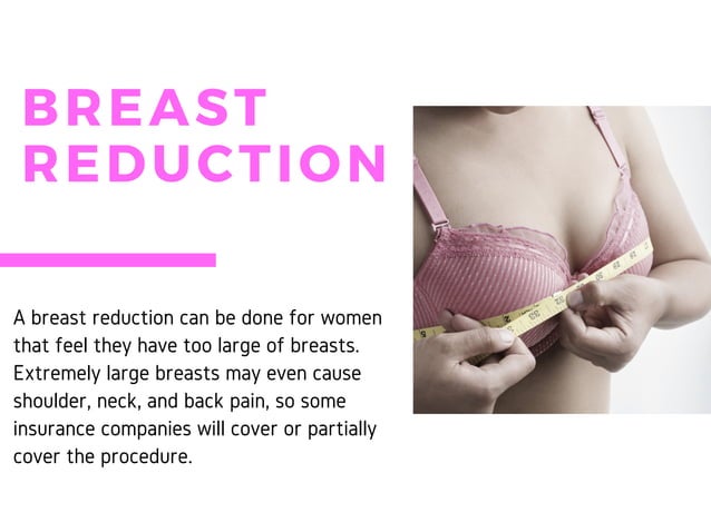 What Are My Breast Augmentation Options? | PDF | Cosmetic Medical Services | Medical Health
