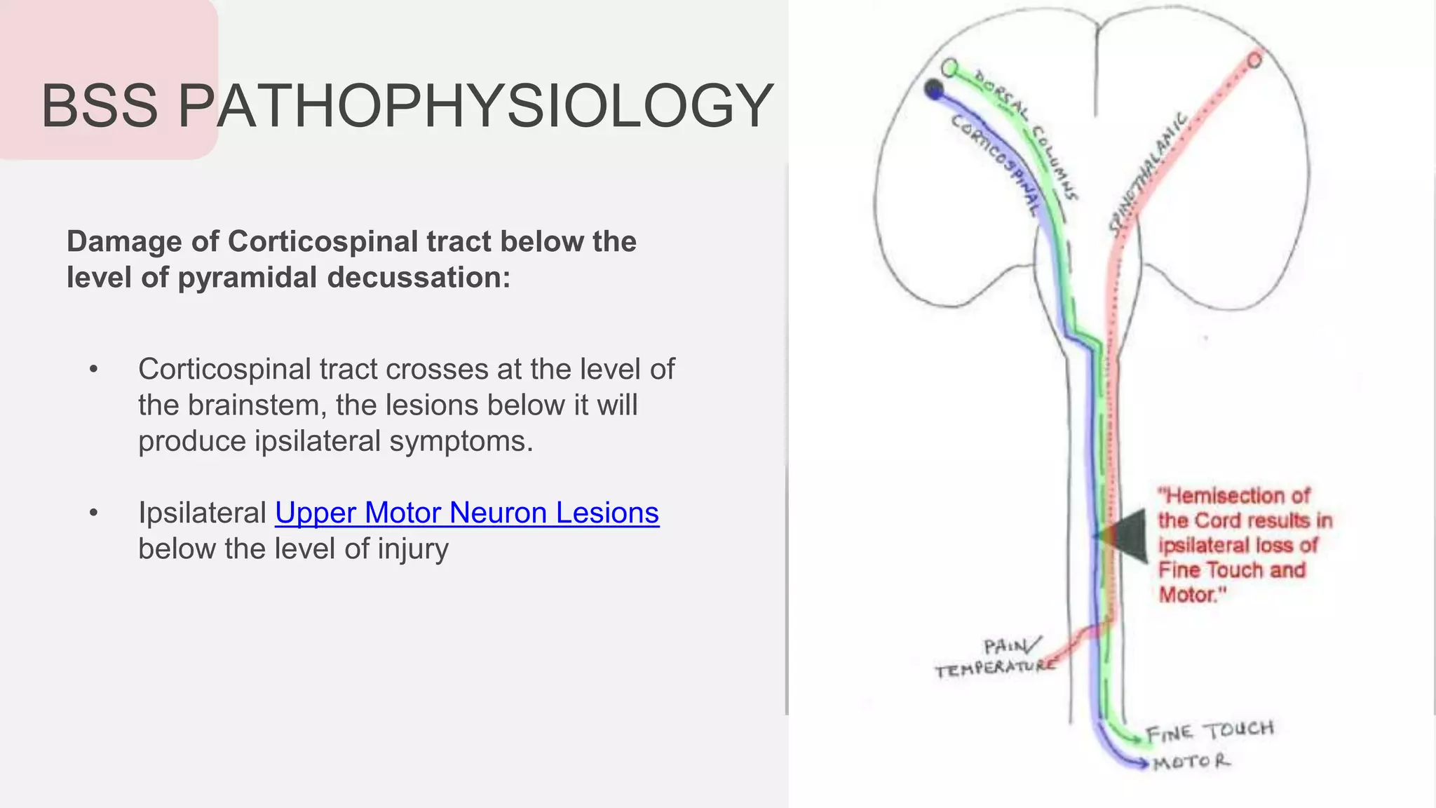 Brown sequard syndrome | PPTX