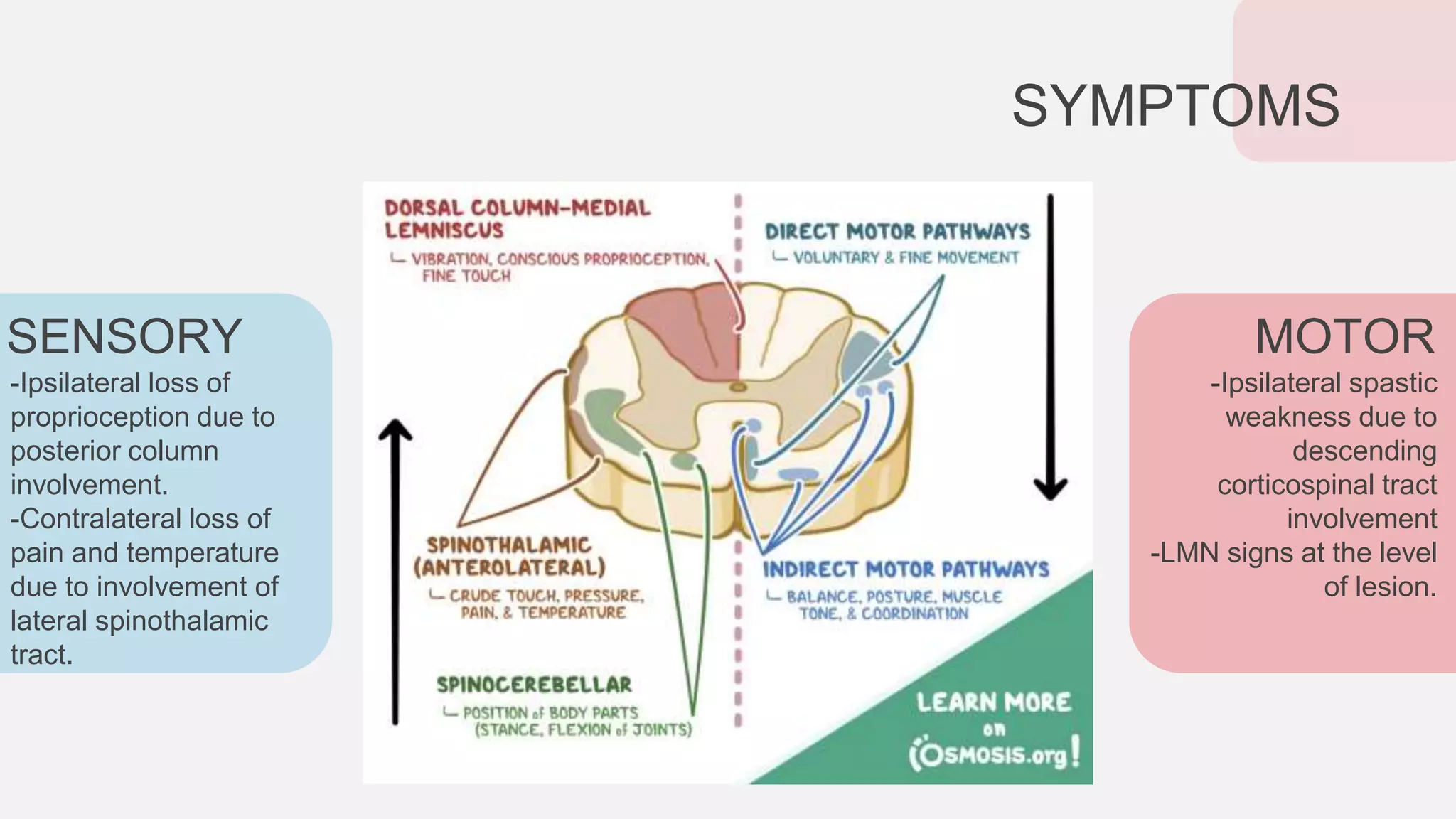 Brown sequard syndrome | PPTX