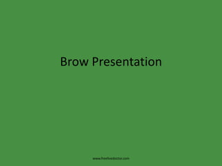 Brow presentation | PPTX