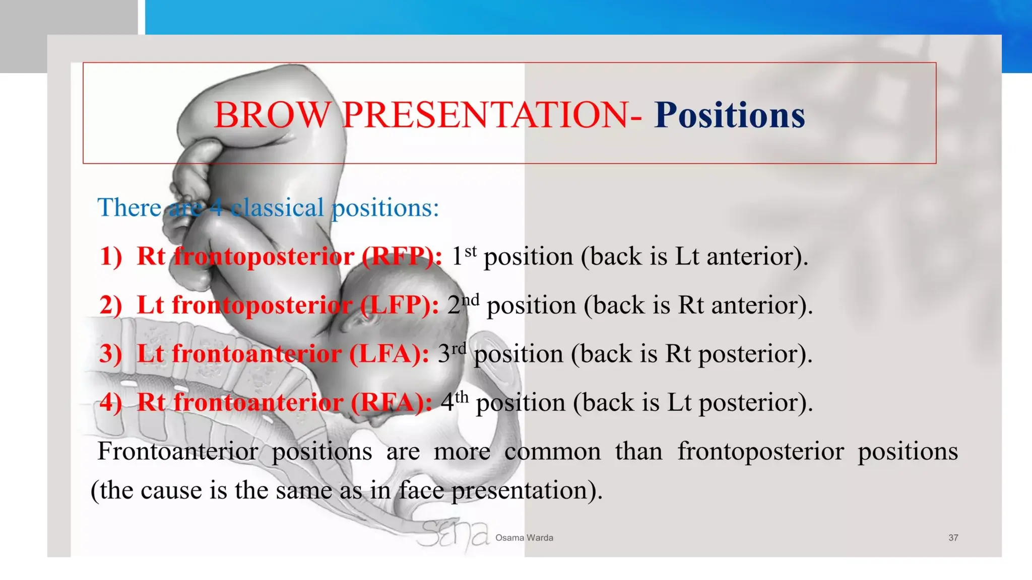 browpresentation-230607041326-26963735.pptx