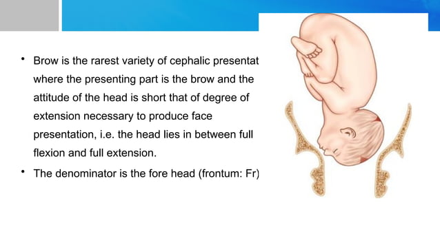 browpresentation-230607041326-26963735.pptx