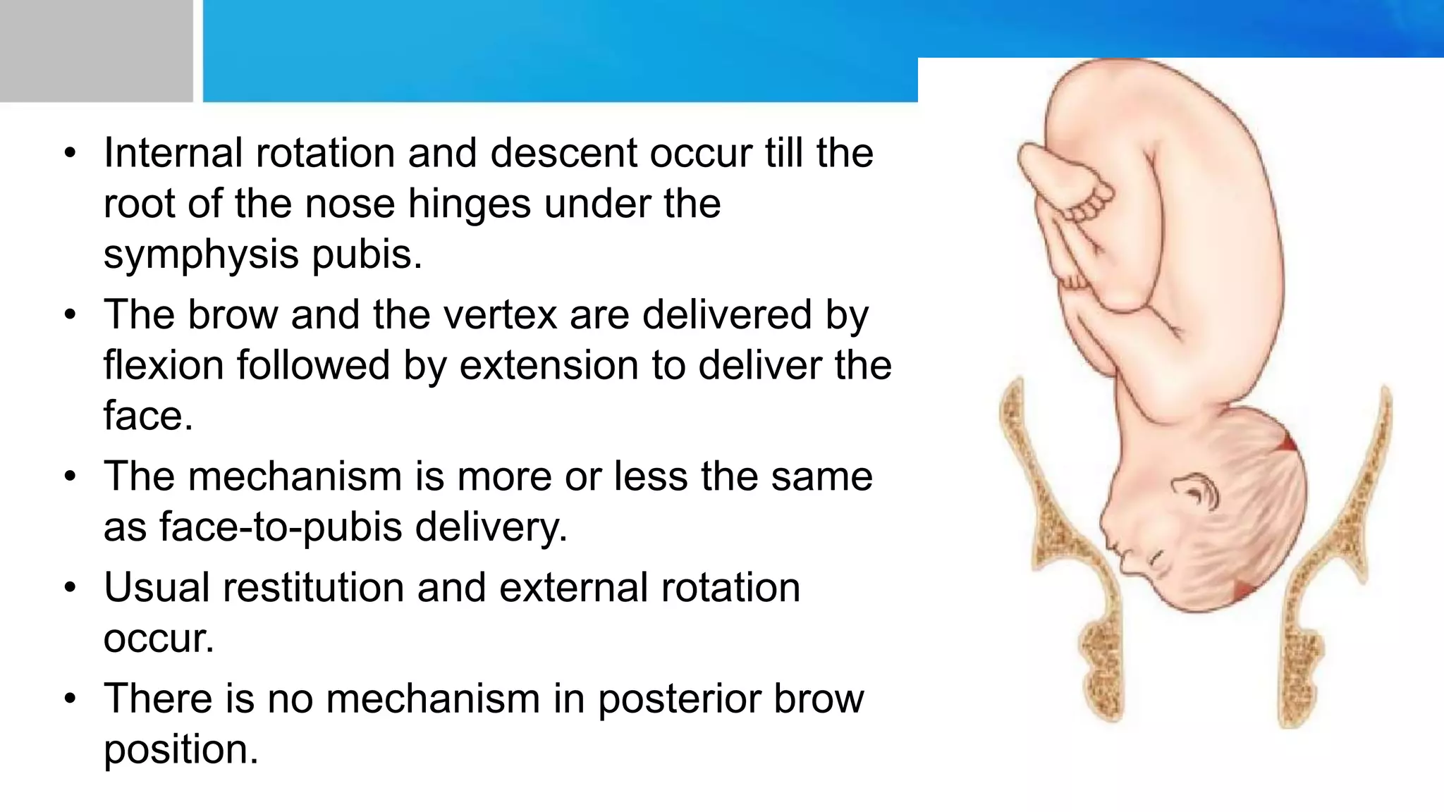 Brow presentation.pptx