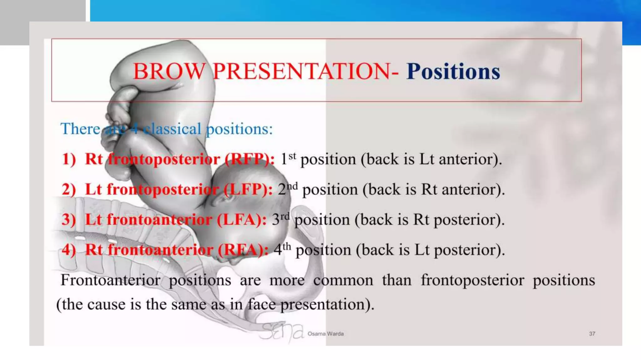 Brow presentation.pptx