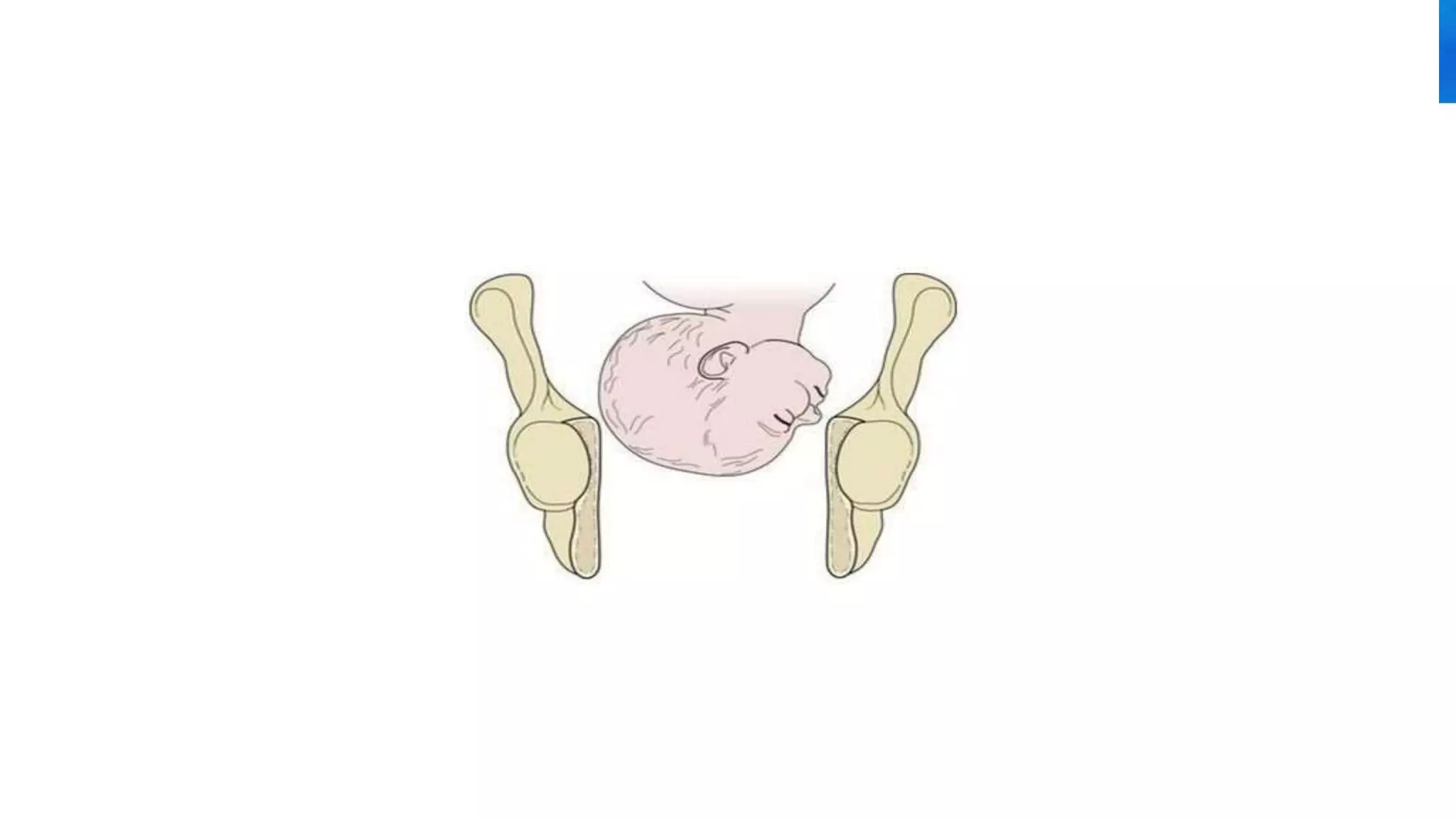 Brow presentation.pptx