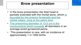 Brow presentation.pptx