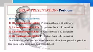 Brow presentation.pptx
