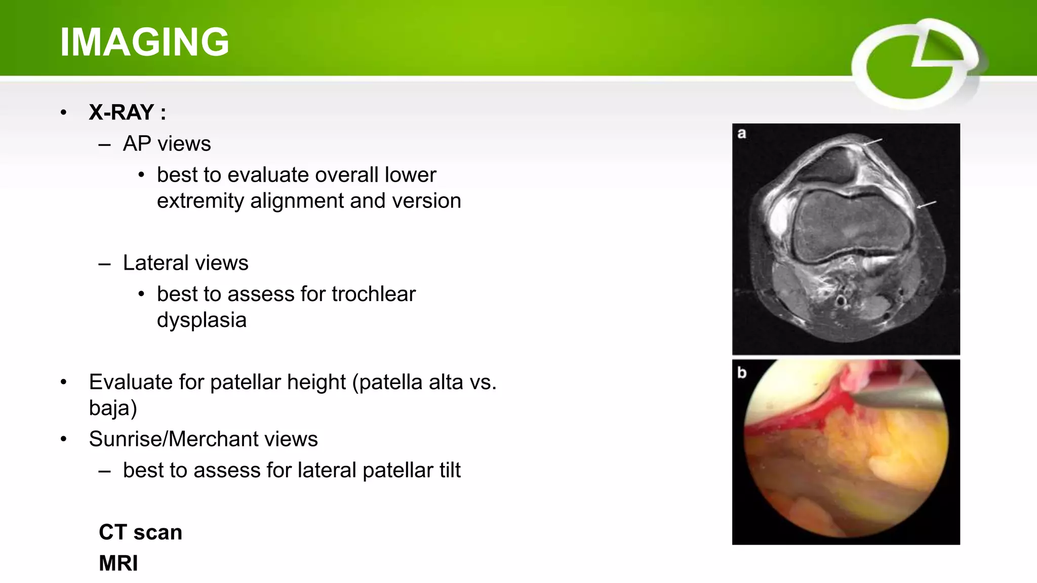 SAF_RECURRENT PATELLA DISLOCATION (1).pptx