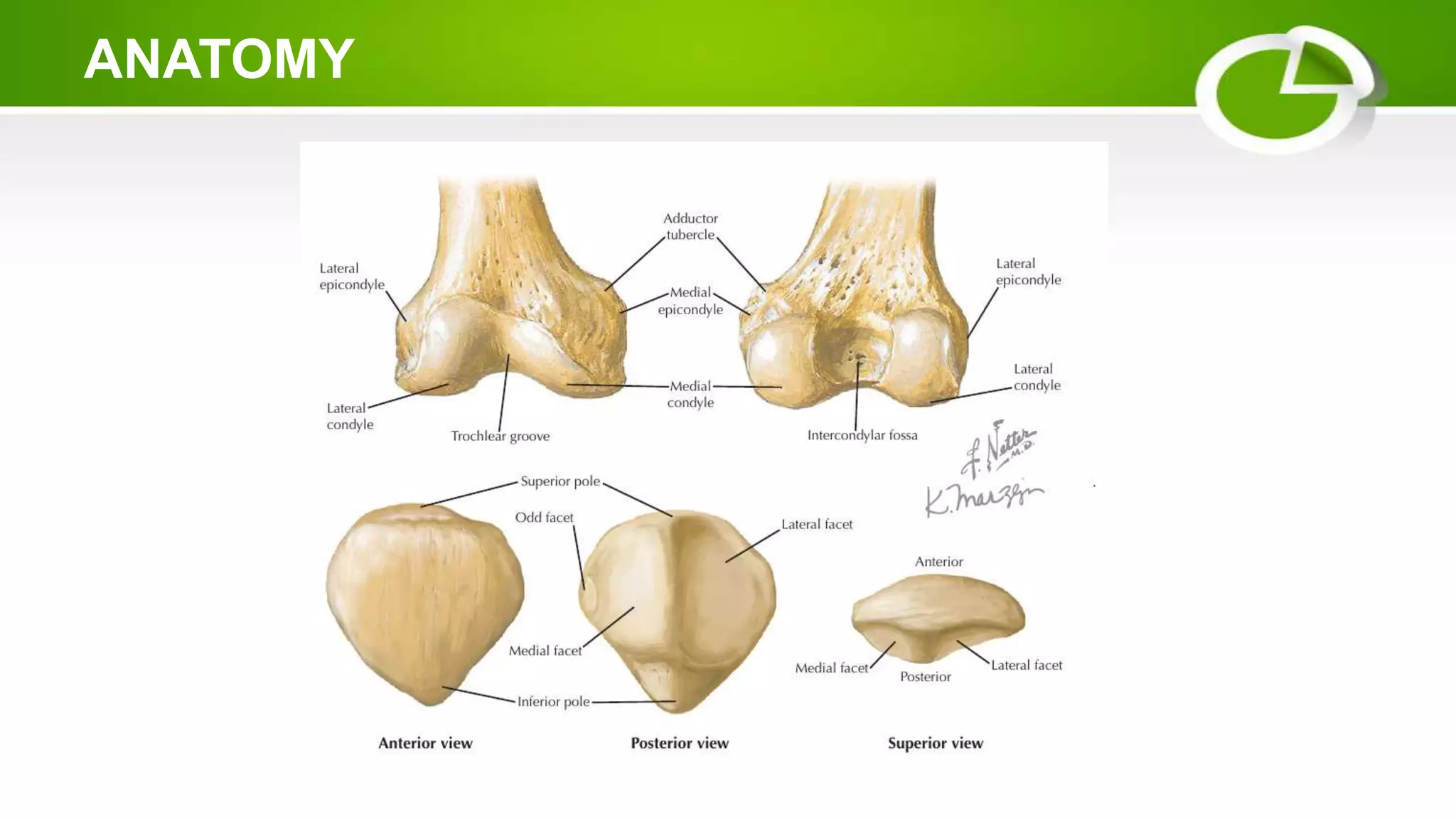 SAF_RECURRENT PATELLA DISLOCATION (1).pptx