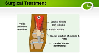 SAF_RECURRENT PATELLA DISLOCATION (1).pptx