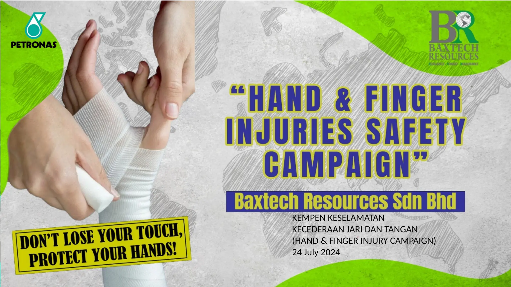 Campaign hand and finger injury safety.pptx