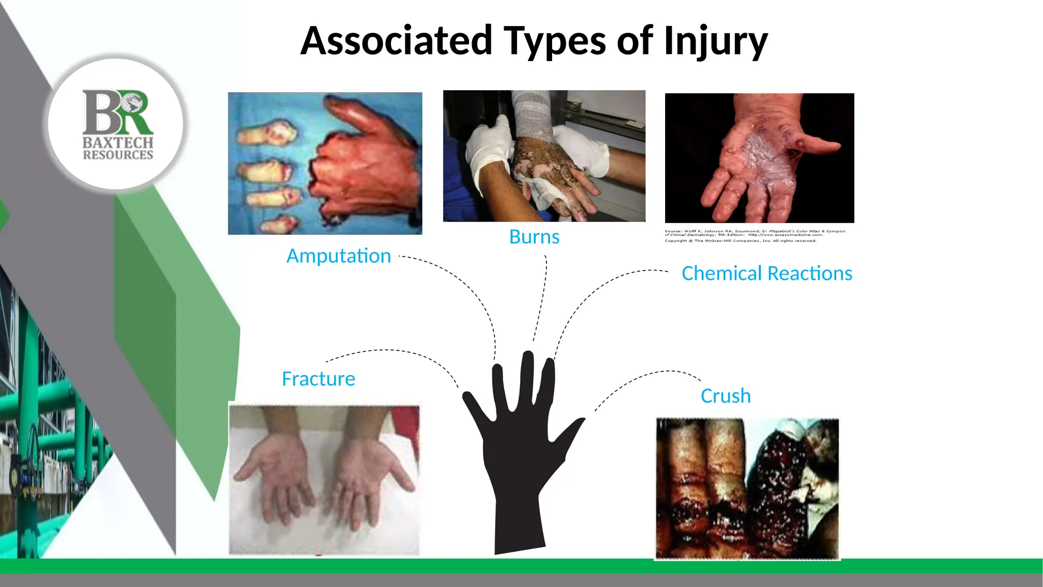Campaign hand and finger injury safety.pptx