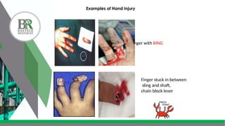 Campaign hand and finger injury safety.pptx