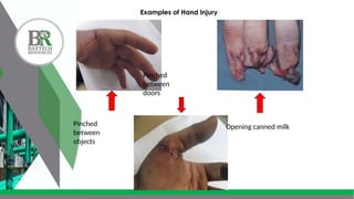 Campaign hand and finger injury safety.pptx
