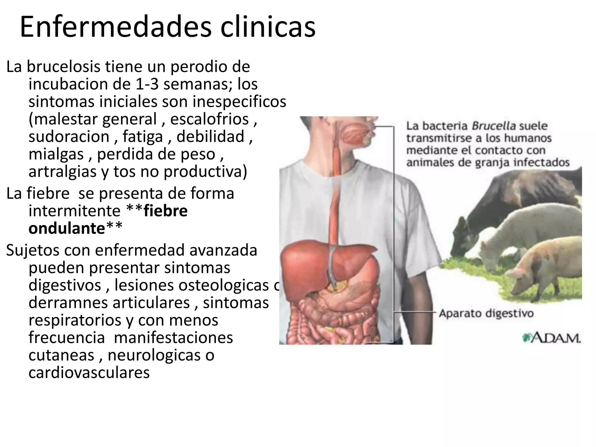 Brucella | PPTX