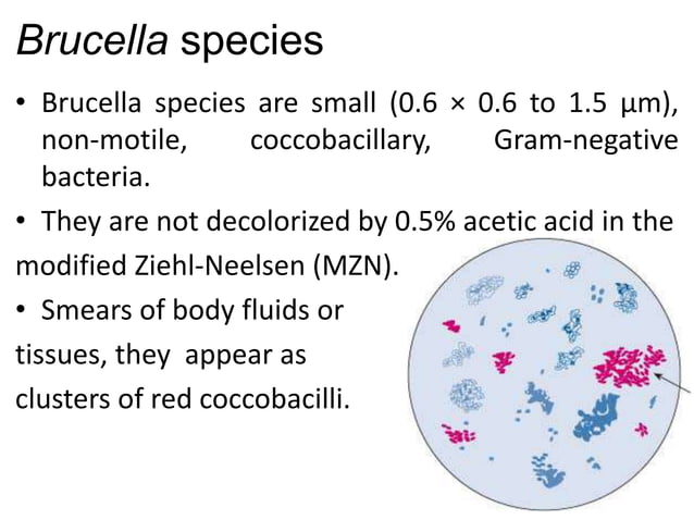 Brucella.pptx