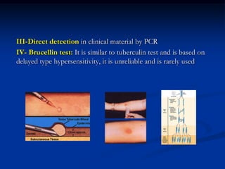 Brucella and mycoplasma | PPSX