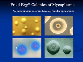 Mycoplasma Pneumoniae Fried Egg Appearance