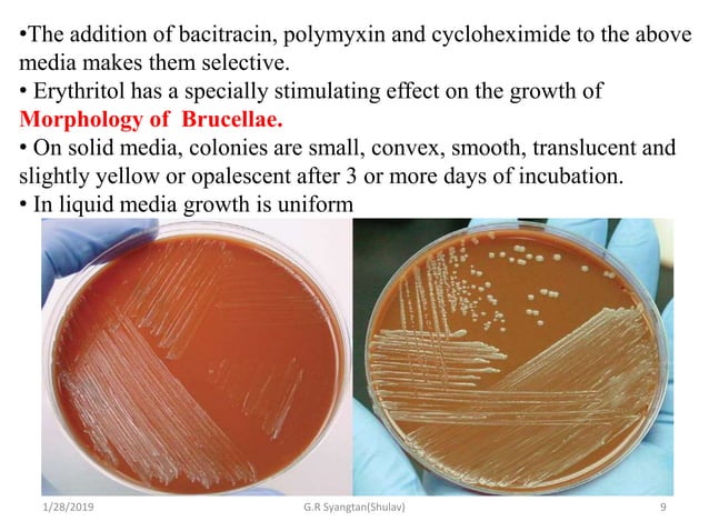 Brucella spp /Brocellosis | PPTX | Infectious Diseases | Diseases and ...