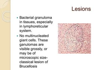 Brucellosis | PPTX