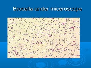 Brucellosis | PPT