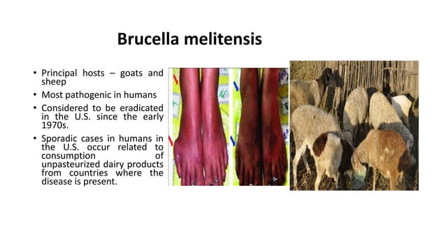 brucellosis.pptx | Infectious Diseases | Diseases and Conditions