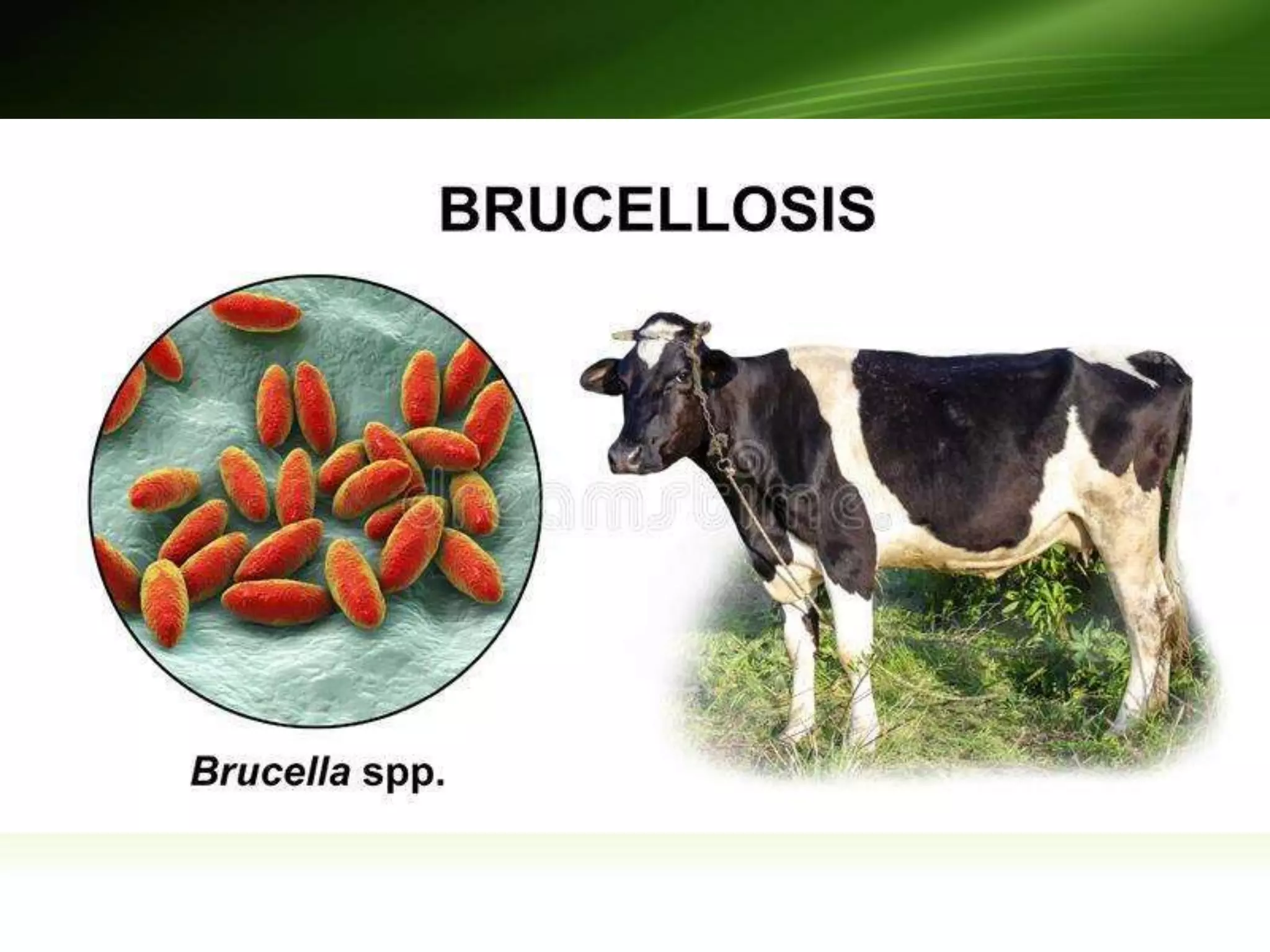 brucellosis.pptx