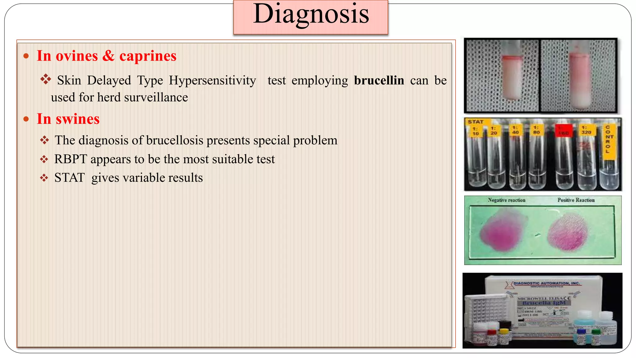 Brucellosis.ppt