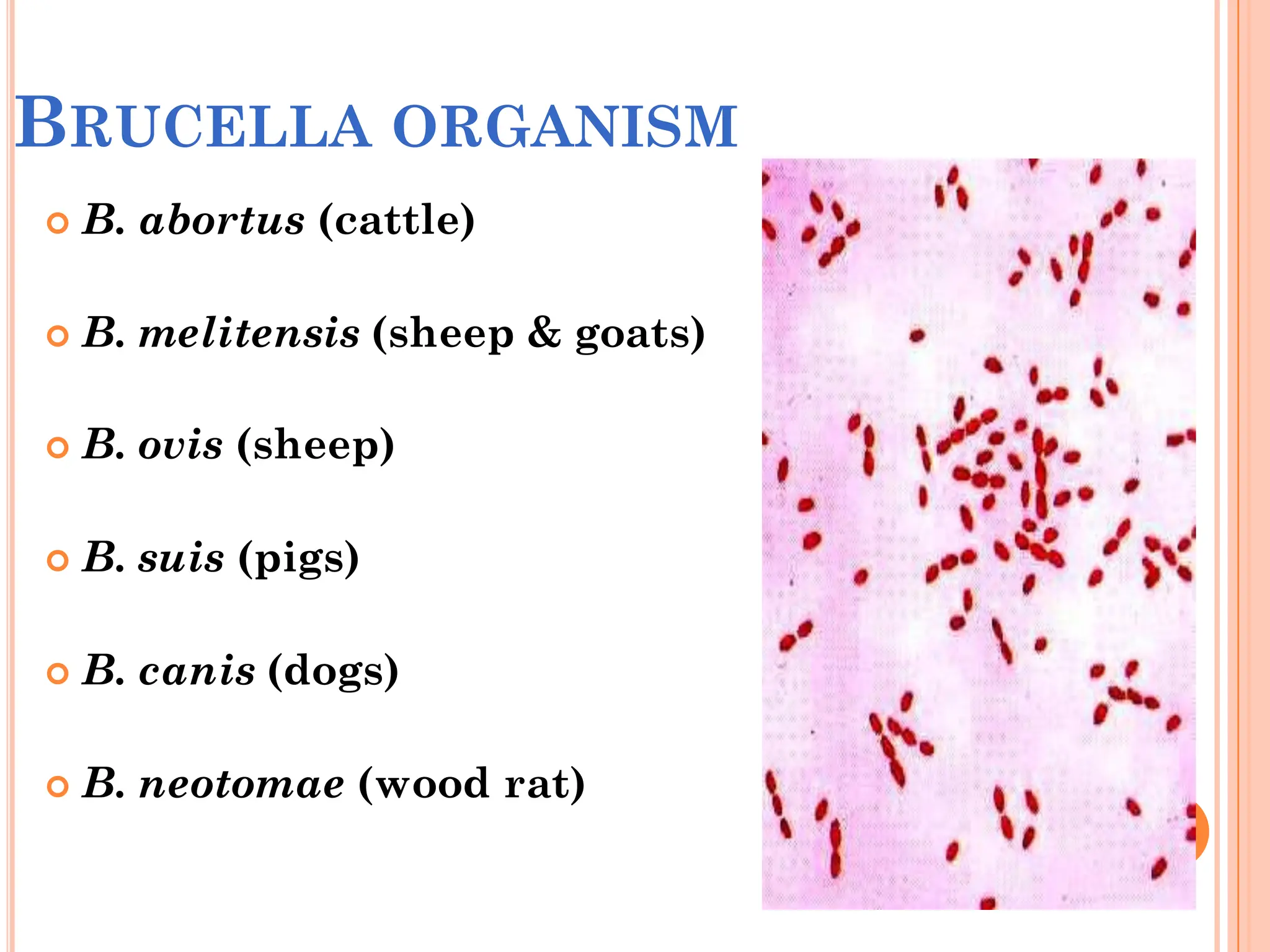 brucellosis and clinical features , .pdf