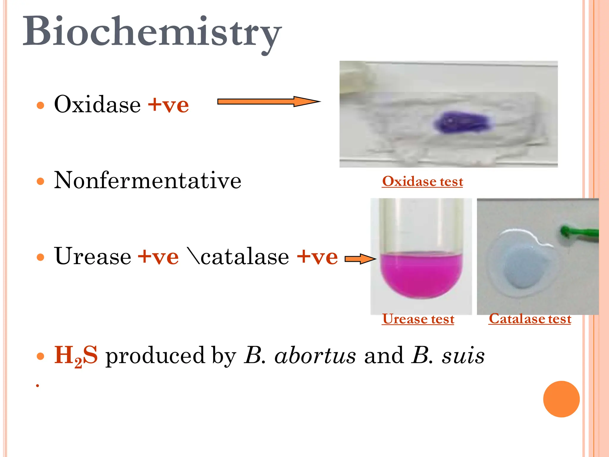 brucellosis and clinical features , .pdf