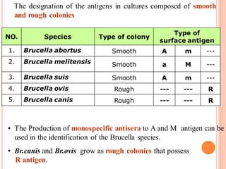 brucellosis and clinical features , .pdf