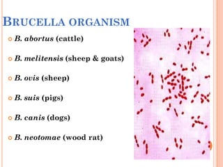 brucellosis and clinical features , .pdf