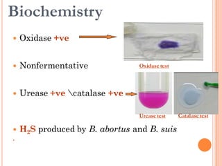 brucellosis and clinical features , .pdf