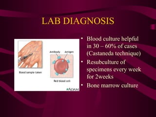 Brucellosis_aetio, patho, lab diagnosis.ppt