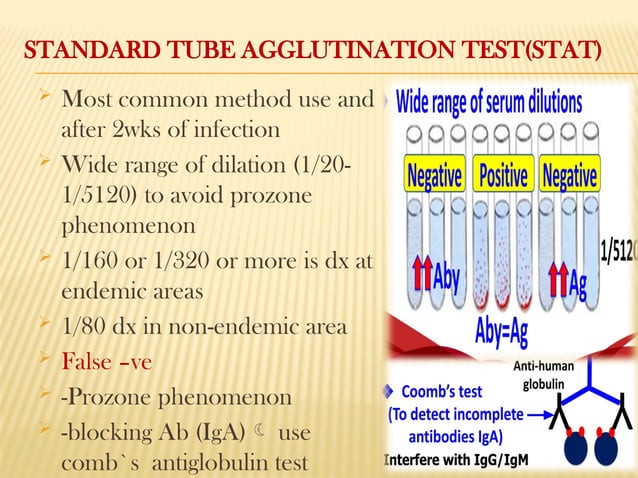 Brucellosis disease or undulatingfever-.pptx