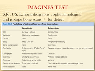 Brucellosis disease or undulatingfever-.pptx