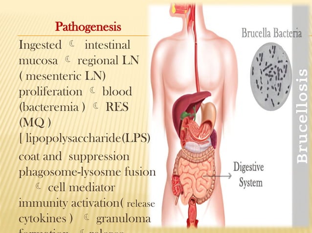 Brucellosis disease or undulatingfever-.pptx