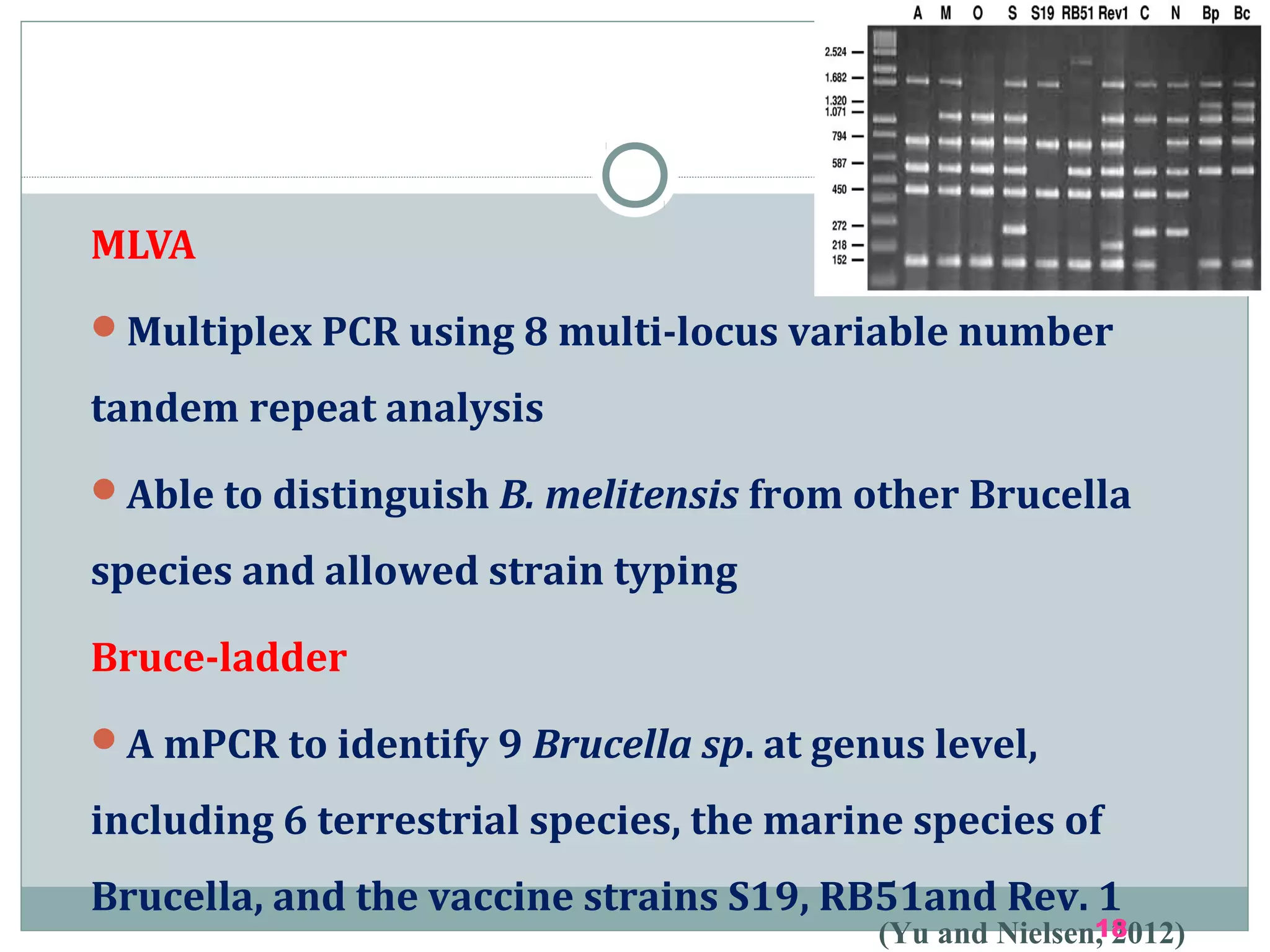 Brucellosis | PPT