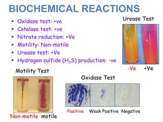 Brucellosis_Dr. J. B. Kathiriya-converted.pptx