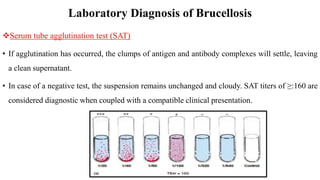 Brucellosis dx.pptx