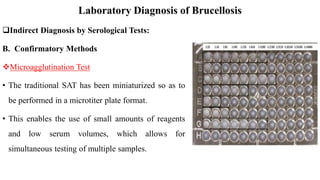 Brucellosis dx.pptx