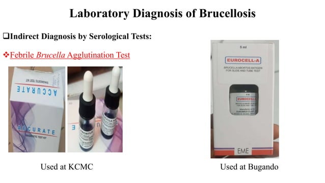 Brucellosis dx.pptx