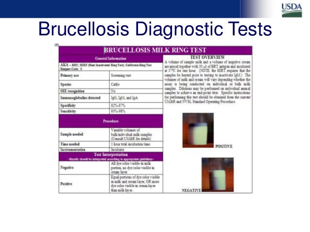 Differential diagnosis of brucellosis serologic reactions