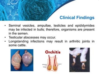 Brucellosis | PPTX | Infectious Diseases | Diseases and Conditions