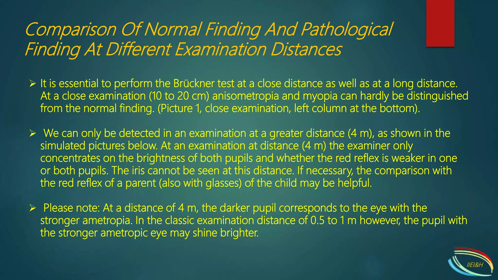 Bruckner test | PPTX