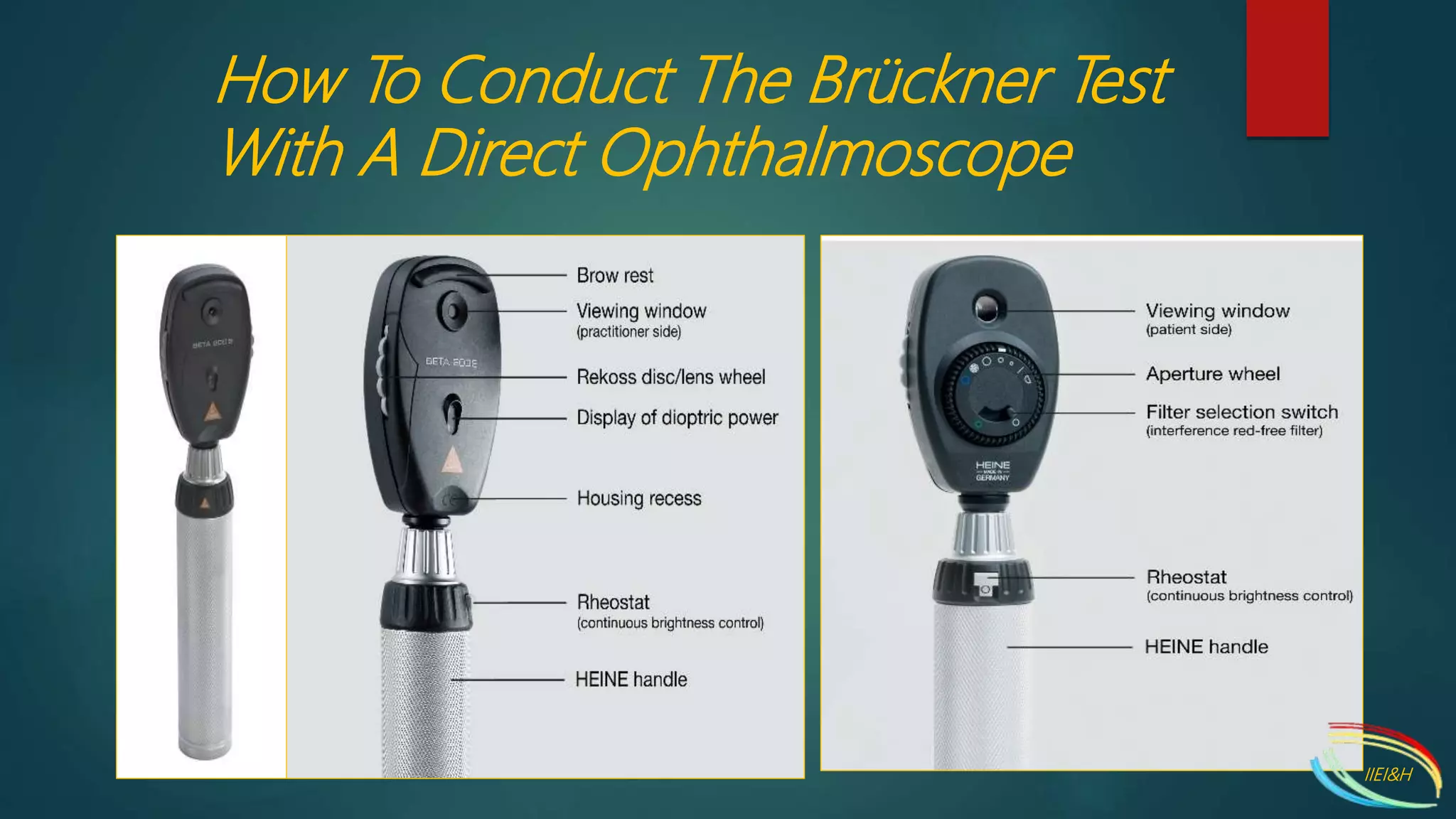 Bruckner test | PPTX