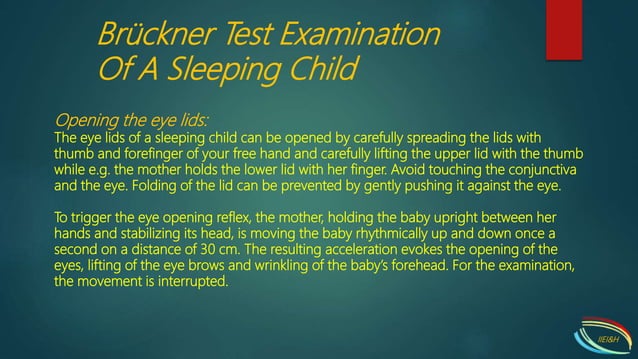 Bruckner test | PPTX | Eye and Vision Conditions | Diseases and Conditions