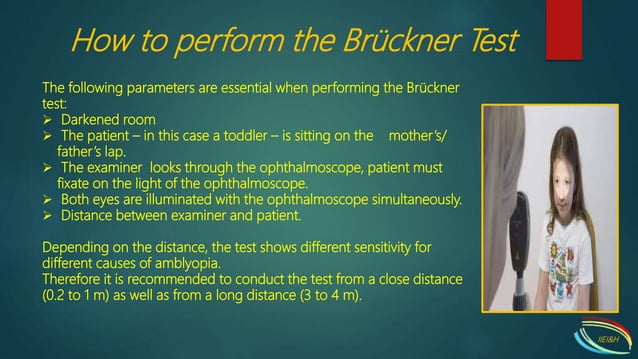 Bruckner test | PPTX | Eye and Vision Conditions | Diseases and Conditions