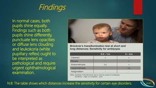 Bruckner test | PPTX